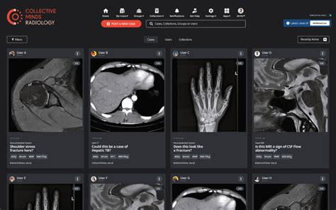 Best Dicom Viewers For Windows Macos Web And Mobile 2024 Radiogyan
