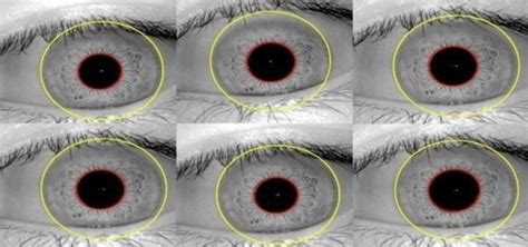 Iris Localization Daugman 1994 Download Scientific Diagram