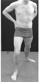 Orthopaedic Tests 6 Hip Buttock Groin Flashcards Quizlet