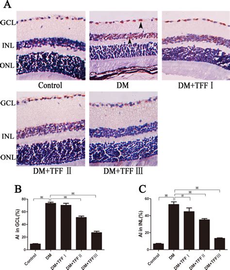 Treatment With Total Flavonoids From Flos Puerariae Tff Attenuated