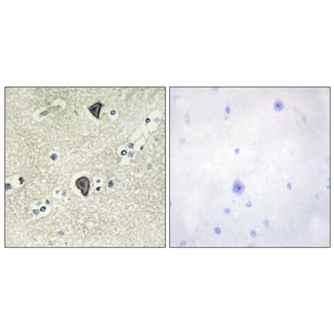 Anti Fgfr3 Antibody A95880
