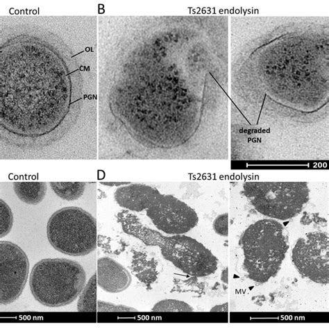 Transmission Electron Microscopy Of T Thermophilus Hb8 And A