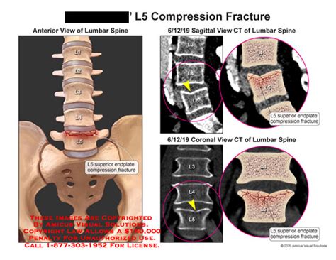 Medical Exhibits Demonstrative Aids Illustrations And Models