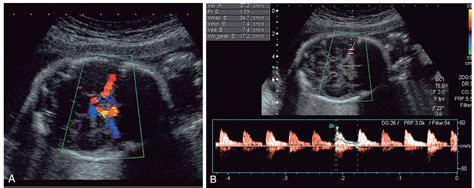 Manual De Doppler Radiologia Online