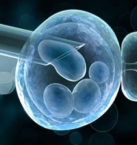 Preimplantation Genetic Testing Pgt Iaso Ivf Medical Center Cyprus