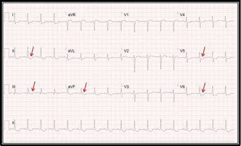 Newsletter June 2023