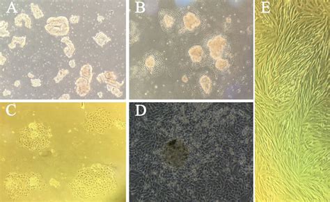 Light Microscopy Of Endometrial Cells A Epithelial Glands B