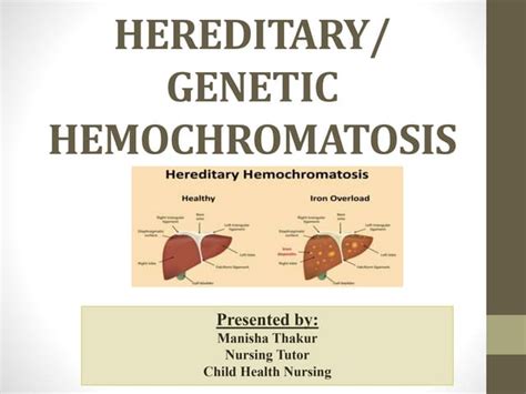 Hereditary Hemochromatosis Hereditary Hemochromatosis Medlineplus