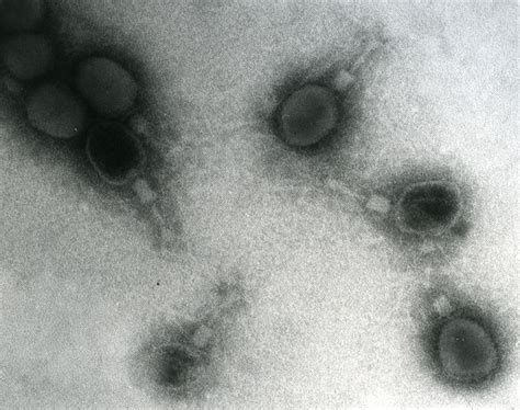 Tem Image Gallery Biomedical Imaging Unit University Of Southampton