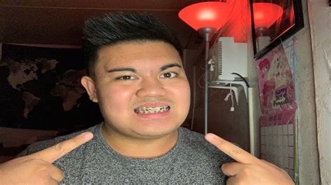 Asmr I Got Braces Youtube