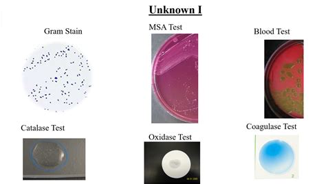 Steps For Identification Of Unknown Bacteria Lab Chegg
