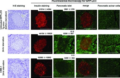 Starvation Induced Autophagy In Muscle Tissues But Not In Brain GFP