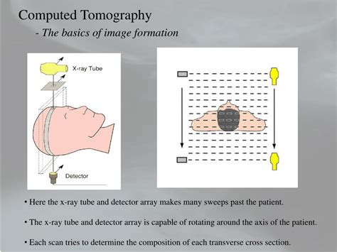 PPT Computed Tomography PowerPoint Presentation Free Download ID