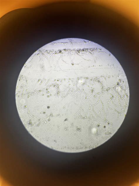 Vaginal Wet Mount R Microscopy