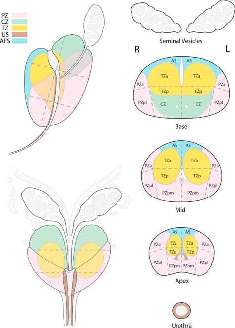Pi Rads Abdominal Imaging Resources