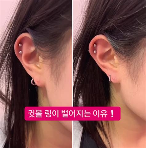 순천피어싱🔺광양피어싱🔺여수피어싱 귓볼 링 귀걸이가 벌어지는 이유는 뚫을때 각도 문제에오 Instagram