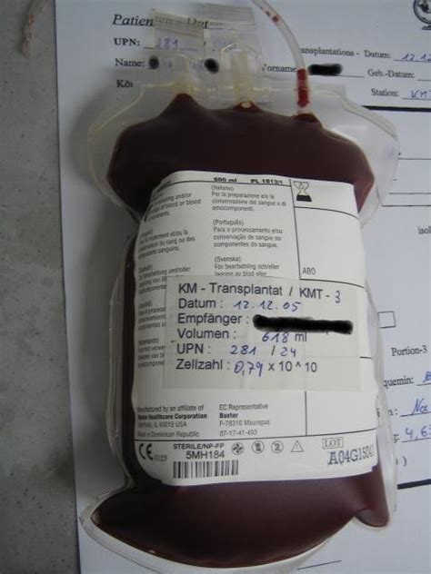 Myeloma Chemotherapy Velcade Revlimid Dex Mrd Stop
