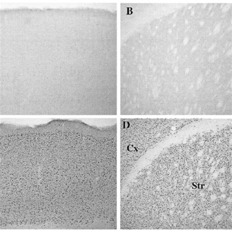 Progressive Formation Of Huntingtin Aggregates Light Micrographs Of