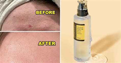 The 8 Best Snail Mucin Products