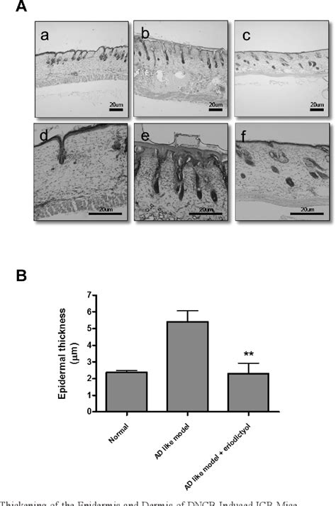 Figure 3 From Effect Of Eriodictyol On The Development Of Atopic