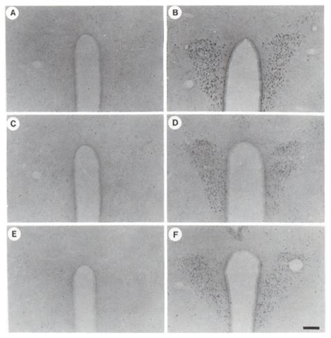 Time Course Of Fos Induction In The Pvn After Hypertonic Saline Stress