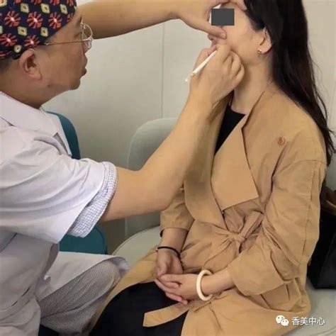 医美中心丨专家出诊，全面部线雕、全面部年轻化，您要的我们都有效果