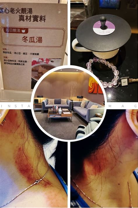唐安麒 Angel Tong 最近很多粉絲紛紛po出做完「韓式」舒筋活絡療程後的出痧美背圖，分享做完全身輕鬆的感覺