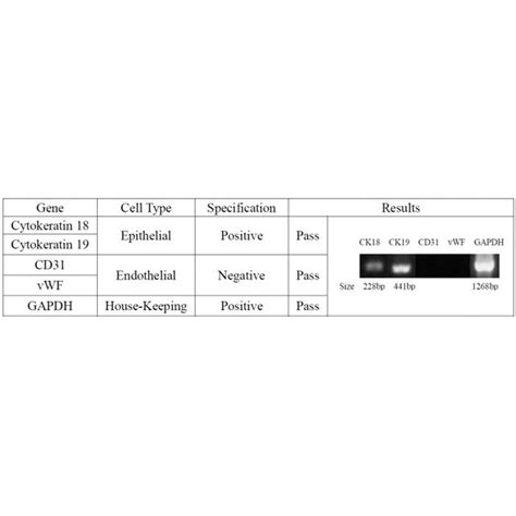Get Human Primary Bronchial Epithelial Cells From Mbp Inc