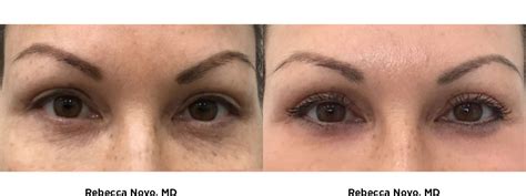 Hetter Peel For Your Best Self