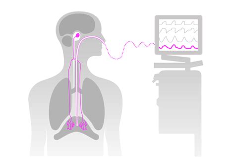 Servo U N How To Use Nava Getinge