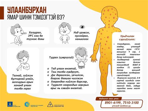 Дорноговь 👶🧼 Улаанбурхан өвчнөөс сэргийлье 🛡️ 1️⃣ Дархлаажуулалтаа