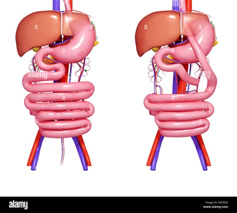 Gastric Bypass Procedure Cut Out Stock Images And Pictures Alamy