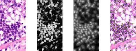 The Steps Of The Proposed Method For Generic Detection Of Nuclei From Download Scientific