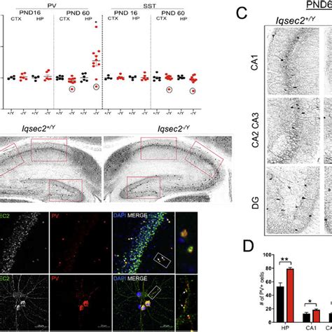 Iqsec2 Expression And Reactive Gliosis In The Hippocampus A Sagittal Download Scientific