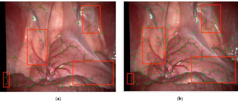 Figure 10 From A Vascular Feature Detection And Matching Method Based
