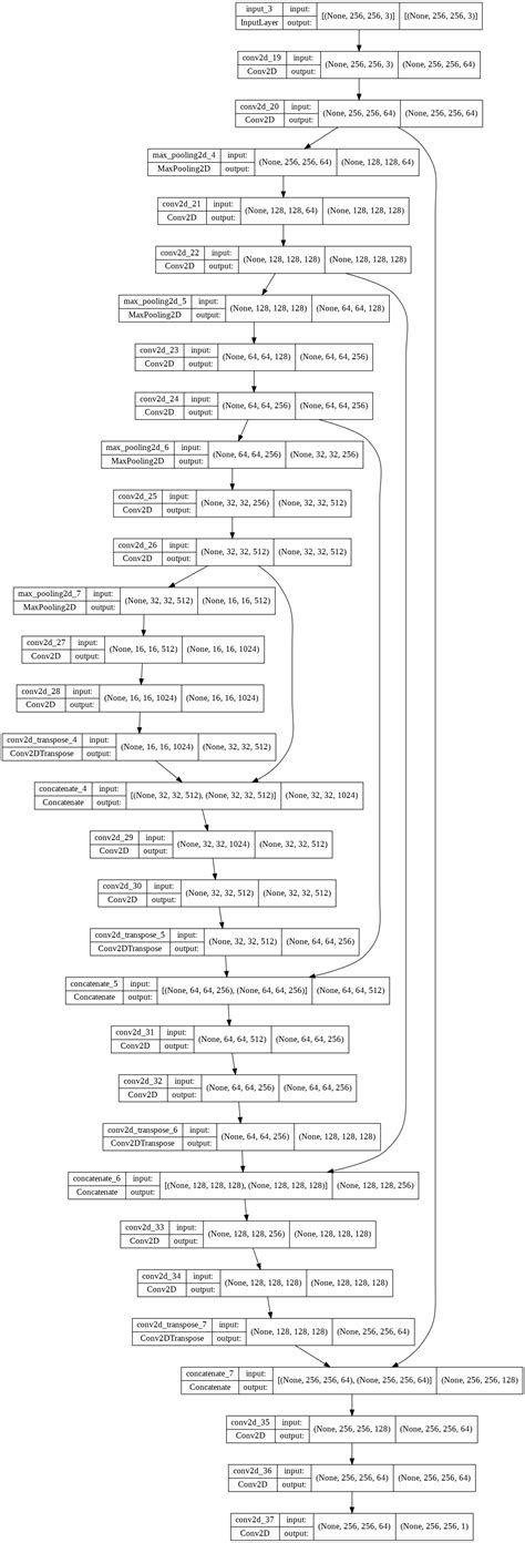 GitHub Youssefkamil Nucleus Breast Cancer Tumor Segementation Segmenting Cells In Sections Of