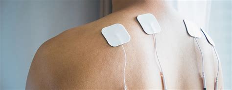 Electrical Stimulation Austin Physical Therapy