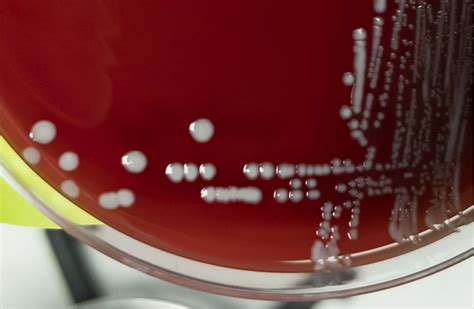 Actinomyces Pyogenes
