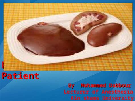 PPT Renal Support DOKUMEN TIPS