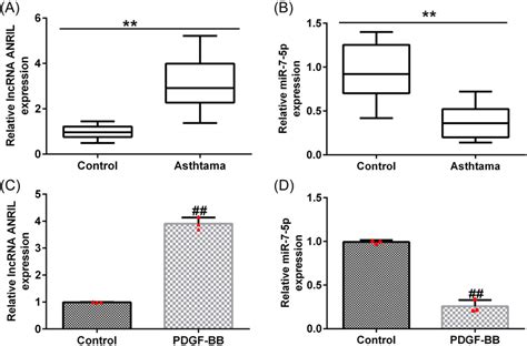 Expression Of Long Noncoding Rnas Lncrna Anril And Mir‐7‐5p In Serum