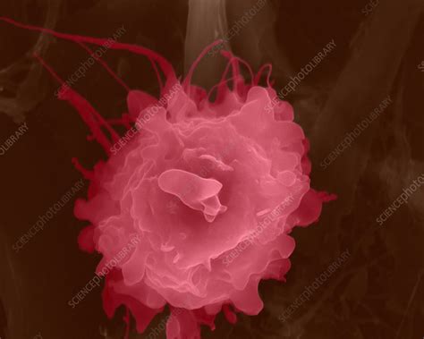 Apoptotic Muscle Cell Sem Stock Image C0320161 Science Photo