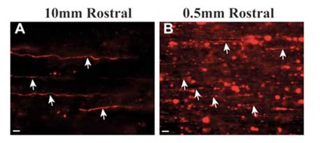 Axonal Tracing Of Corticospinal Neurons From The Motor Cortex