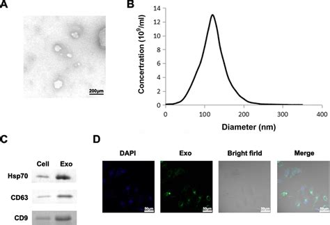 Characteristic Of Hcc Derived Exosomes A B Tem And Nta Were Applied