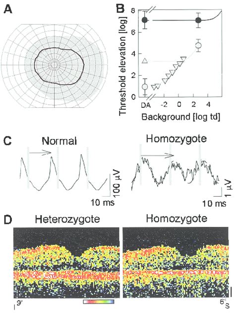 Human Phenotype Of Putative Null Mutation In Rpe65 A Kinetic Visual