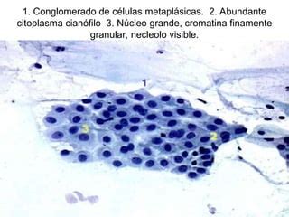 Clase De Citología Vaginal Ii Anatomía E Histologíappt