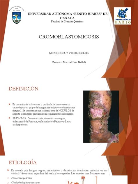 Cromoblastomicosis Pdf Especialidades Medicas Ciencias De La Salud