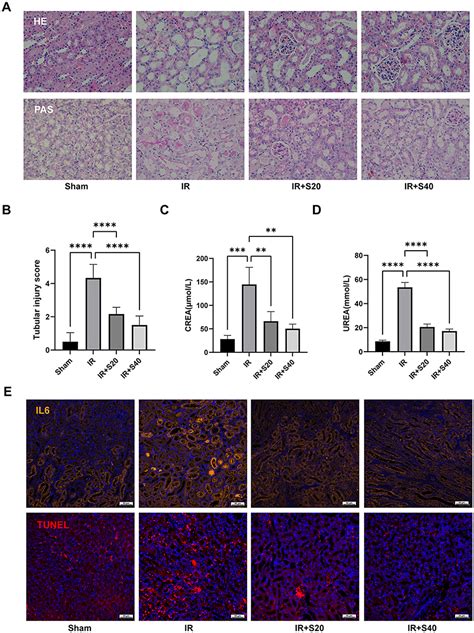 Schisandrin B Ameliorates Renal Ischemia Reperfusion Injury Via Target DDDT