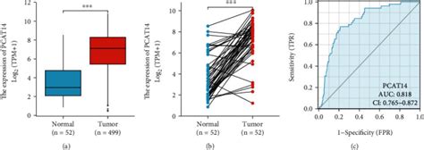 Lncrna Pcat14 Is A Diagnostic Marker For Prostate Cancer And Is