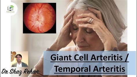 Symptoms Of Arterial Arteritis