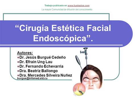 “Cirugía Estética Facial Endoscópica”. - ppt descargar